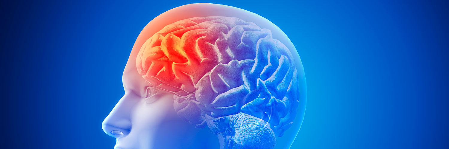 Síntomas y tratamiento de las migrañas | Blog CH Salud